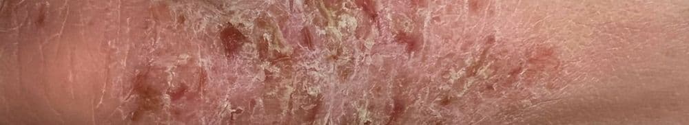 Dermsquared - The leading platform for dermatology professionals